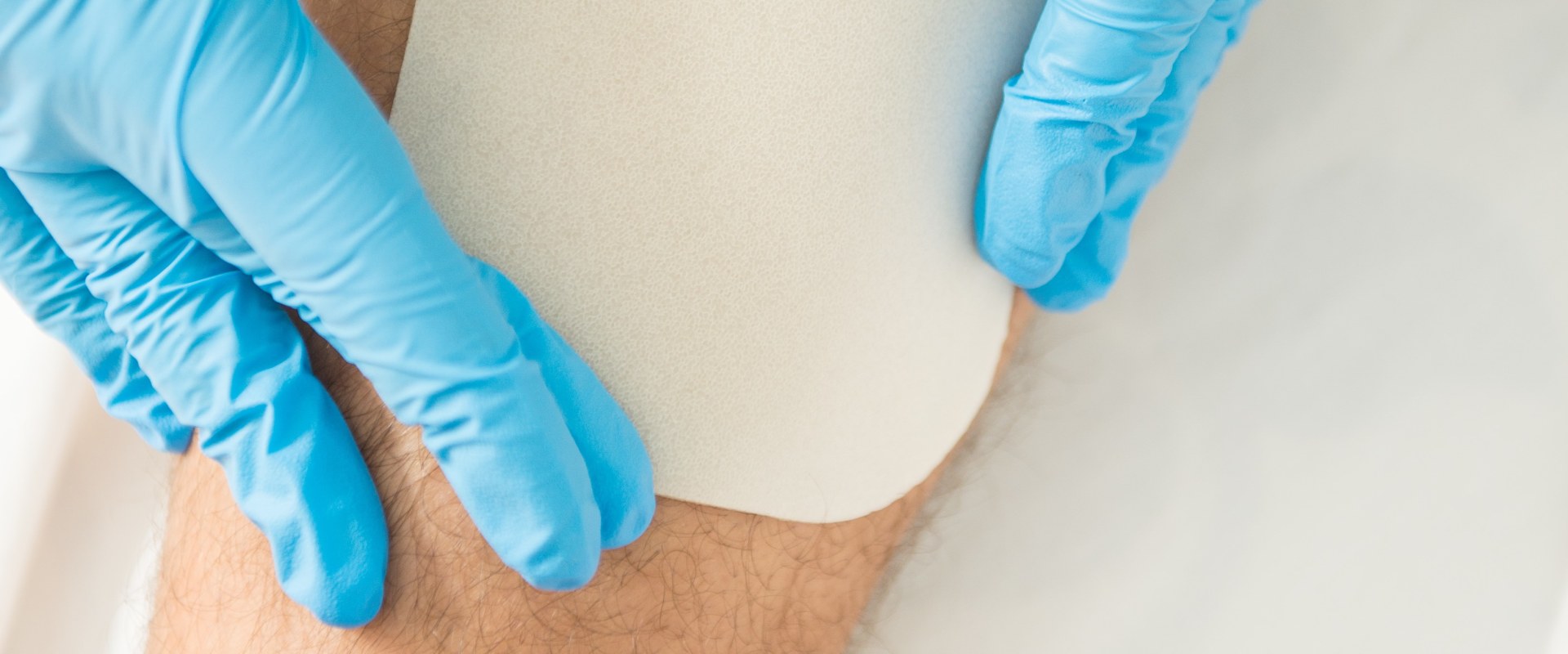 Expert Tips for Proper Wound Care and Healing