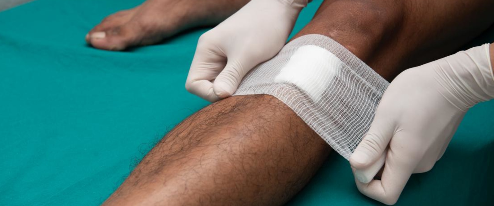 Expert Tips for Applying Gauze to Wounds