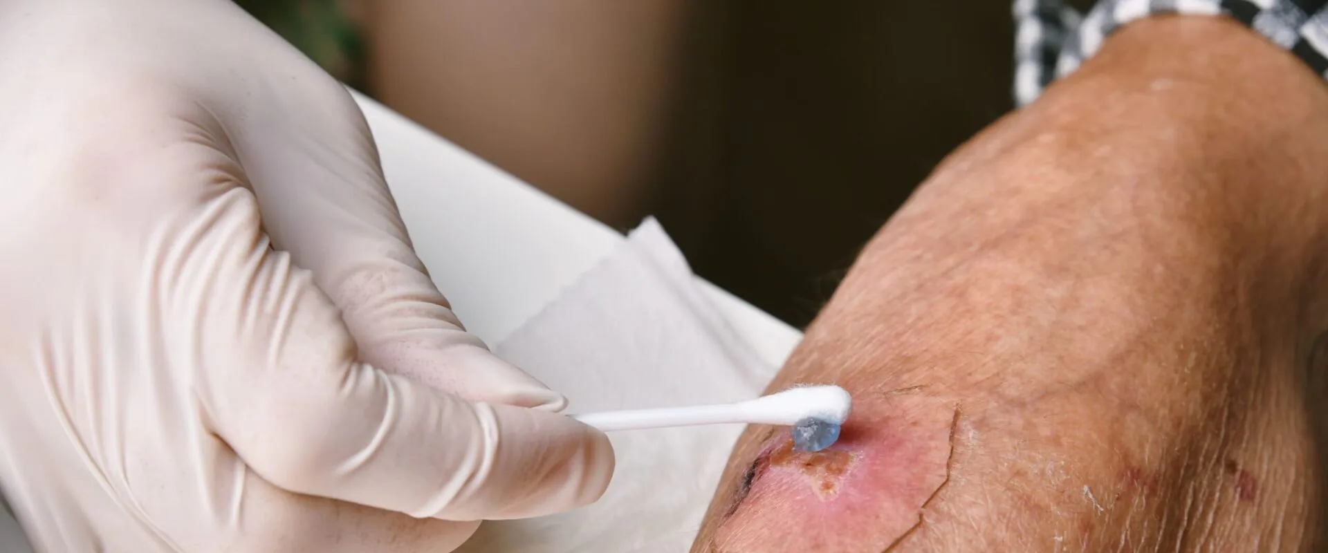 Phases of Wound Healing You Should Know to Prevent Infection